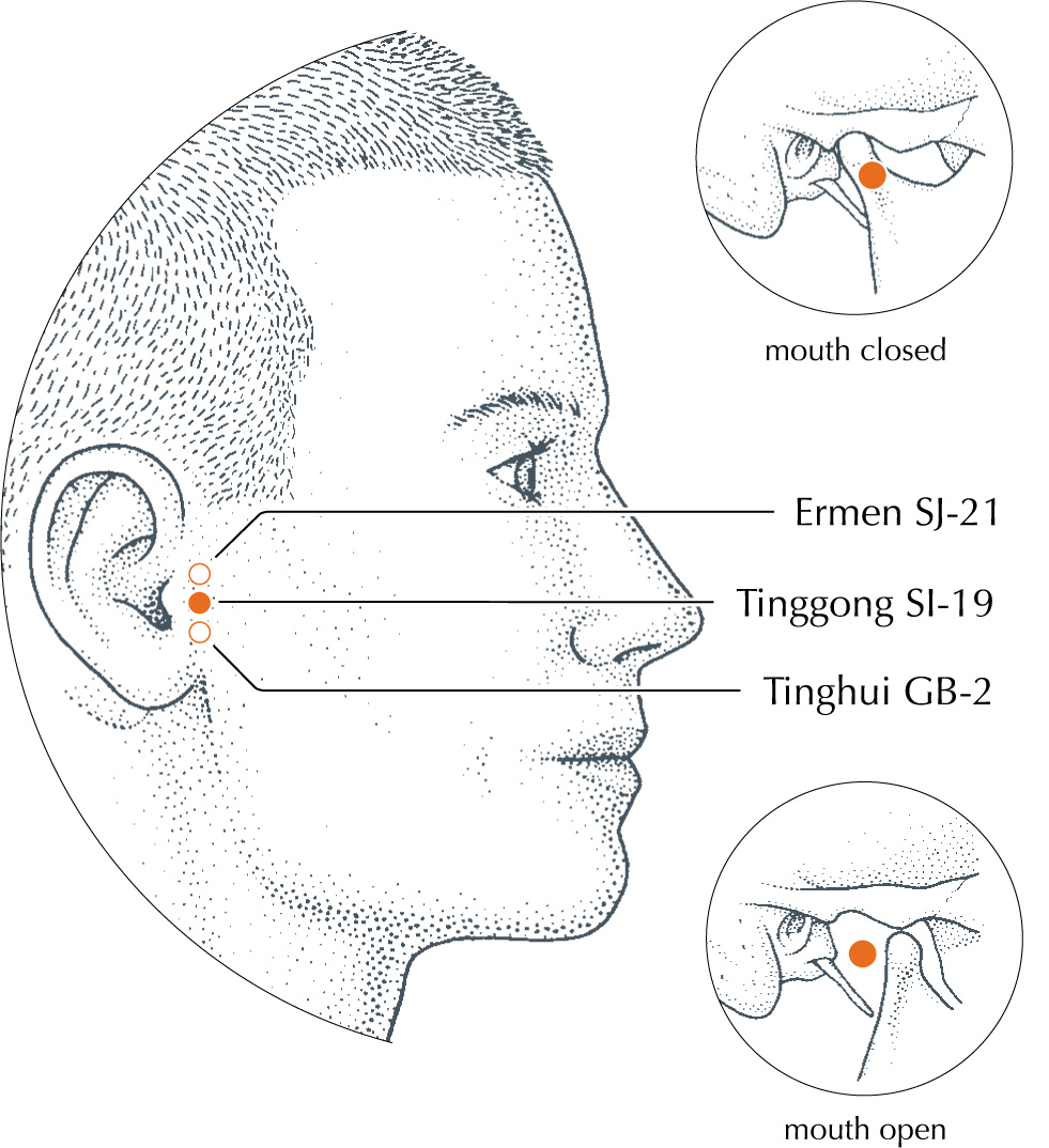 نقطه Si-19 در طب سوزنی: (Tīnggōng| تیانگ گونگ) - خانه هومیوپاتی و طب سوزنی